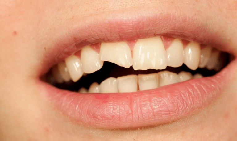 Difference Between Premolar and Molar